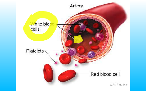 sickle cell disease by grant preuninger on Prezi