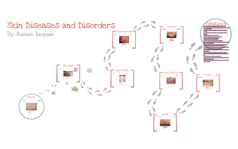 Skin Diseases and Disorders by Ramon Jacquez on Prezi