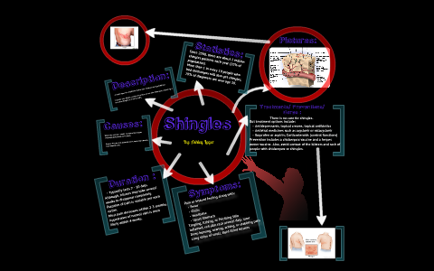 Shingles by Ashley Leger on Prezi