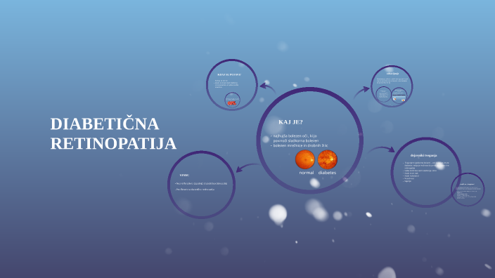 diabetična retinopatija by Katarinca Zupan on Prezi