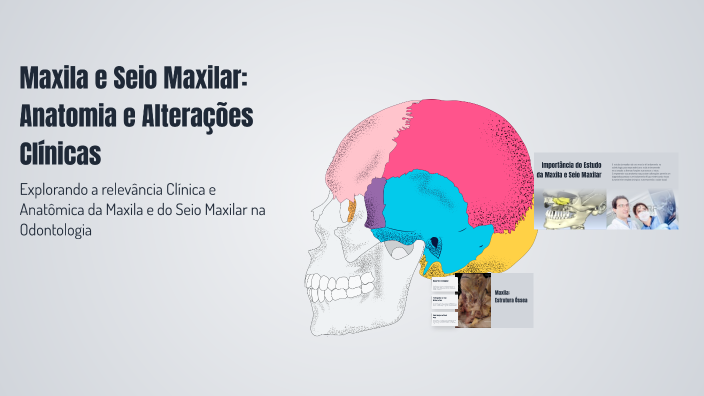Maxila e Seio Maxilar: Anatomia e Alterações Clínicas by Esli Vitoria ...