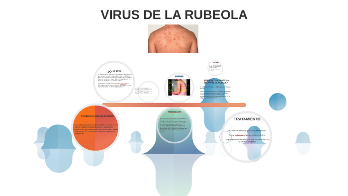 VIRUS DE LA RUBEOLA by jonathan lorena figueroa on Prezi