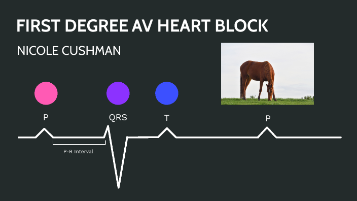 First Degree AV Heart Block by Nicole Cushman on Prezi First Degree AV Heart Block by Nicole Cushman on Prezi