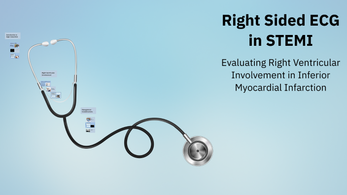 Right Sided ECG in STEMI by Christopher Hernandez on Prezi