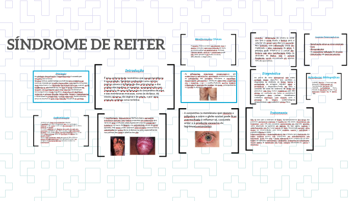 SINDROME DE REITER by Geisa Cardoso on Prezi