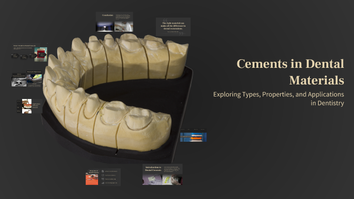Cements in Dental Materials by Vineel on Prezi