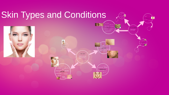 Skin types and conditions by Claire Bothwell on Prezi