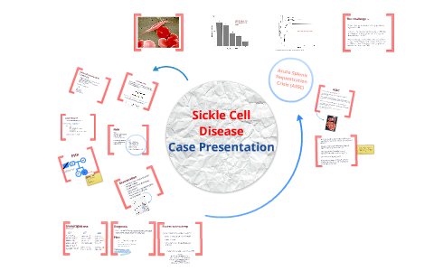 Sickle Cell Disease in children SSC case presentation by Naeem Mitha on ...