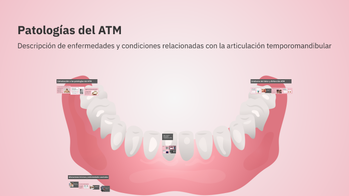 Patologías del ATM by Evelyn Sangacha Merchan on Prezi