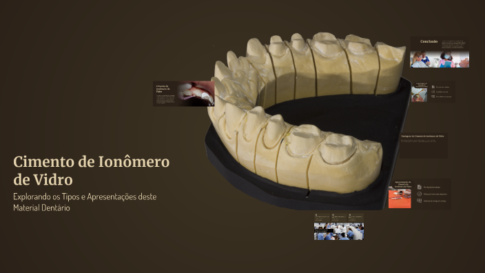 Cimento de Ionômero de Vidro by Samara Carneiro on Prezi