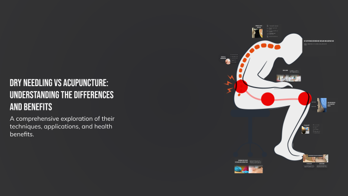 Dry Needling vs Acupuncture: Understanding the Differences and Benefits ...