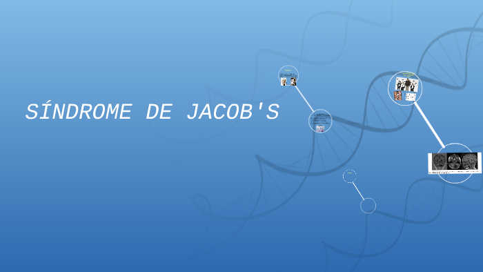 sindrome de Jacob's by sergio mendez on Prezi