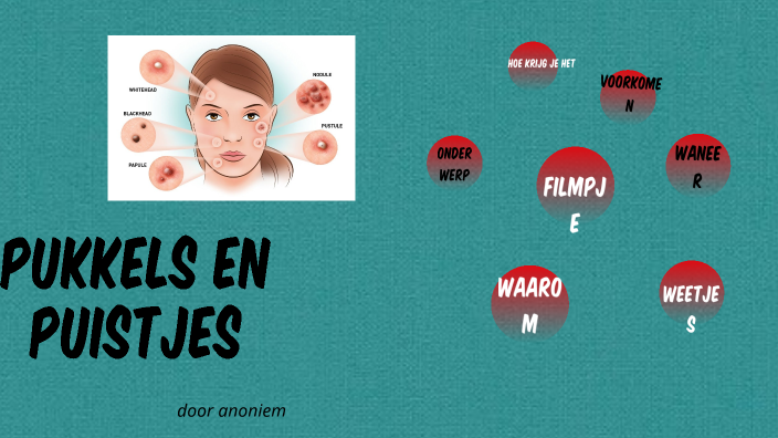 pukkels en puisjes by dylan courtens on Prezi