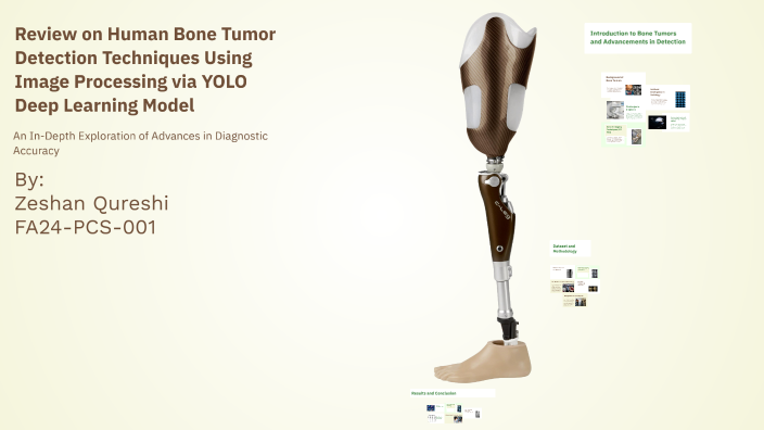 Review On Human Bone Tumor Detection Techniques Using Image Processing