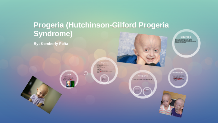 Progeria (Hutchinson-Gilford Progeria Syndrome) by Kem Pena on Prezi
