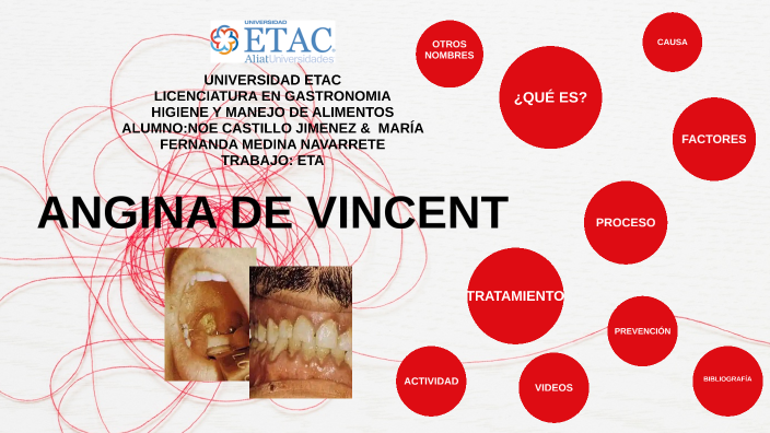 ANGINA DE VINCENT by FERNANDA MEDINA on Prezi