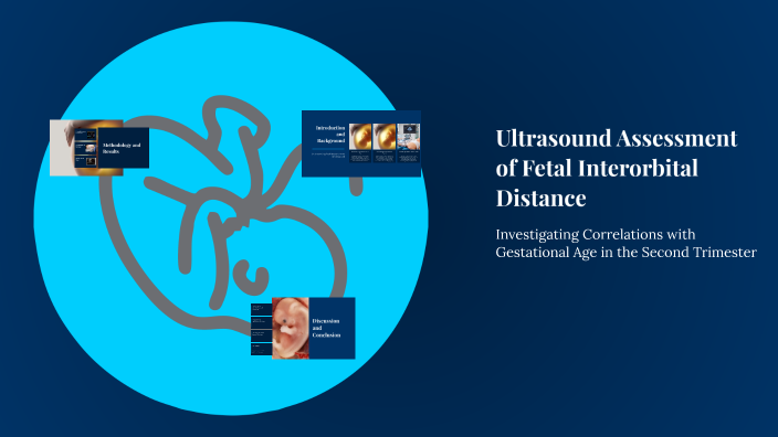 Ultrasound Assessment of Fetal Interorbital Distance by Sonit Khodre on ...