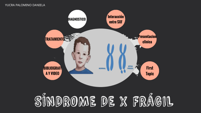 Sindrome x fragil by DANIELA ZULEIKA YUCRA PALOMINO on Prezi