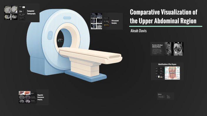 Comparative Visualization of the Lumbar Abdominal Region: CT, MRI, and ...