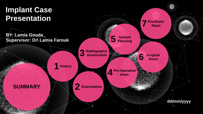 Implant Case Presentation by Lamia Saleh on Prezi