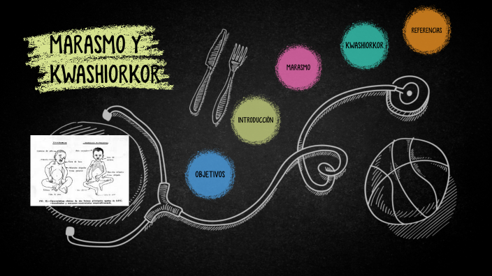 DPC Marasmo y Kwashiorkor by Katy Marro on Prezi