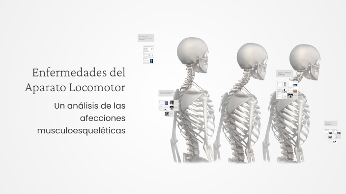 Enfermedades del Aparato Locomotor by Sami Silva on Prezi