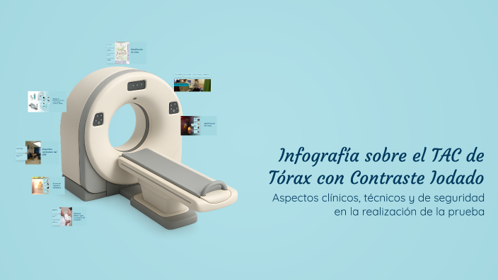 Infografía sobre el TAC de Tórax con Contraste Iodado by Candela ...