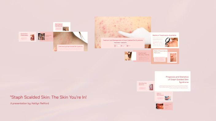 Understanding Staph Scalded Skin Syndrome by khloe washington on Prezi