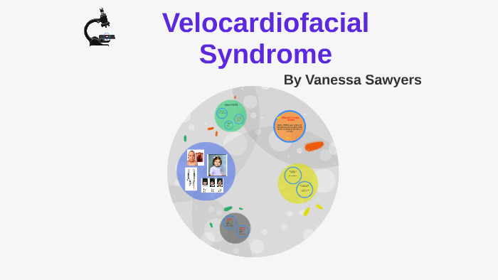 Velocardiofacial Syndrome by Vanessa Sawyers on Prezi