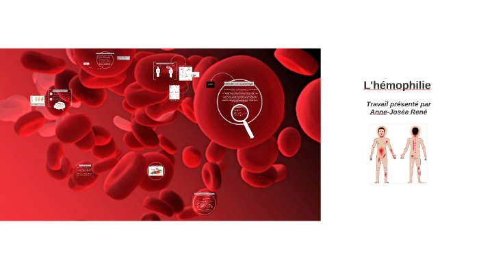 L'hémophilie by Anne-Josée René on Prezi