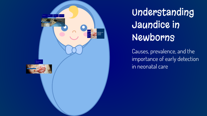 Understanding Jaundice in Newborns by Mahmoud Alissa on Prezi