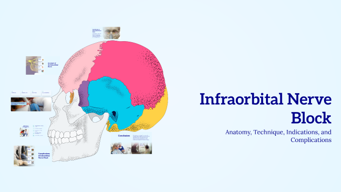Infraorbital Nerve Block by alaa elfadaly on Prezi