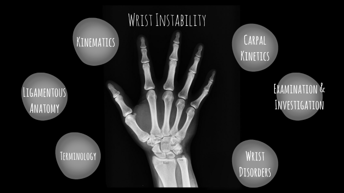 Wrist Instability by Megan O'Connor on Prezi