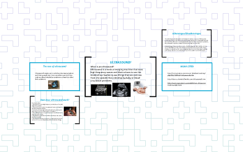 ULTRASOUND! by luca dichio on Prezi