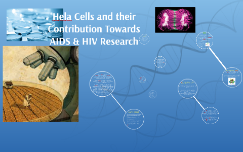 hela cells and their contribution towards AIDS & HIV researc by soymi ...
