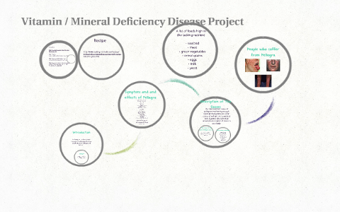 Vitamin / Mineral Deficiency Disease Project by Brianna Pereira on Prezi