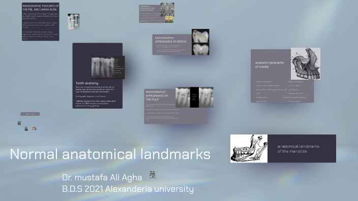 normal landmarks in periapical x-rays by Mustafa Samir on Prezi