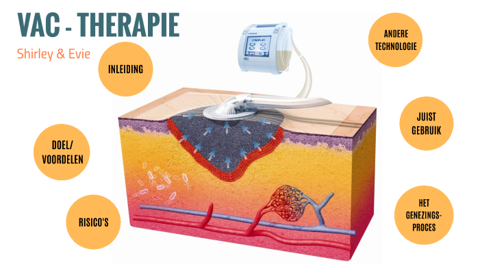 VAC- therapie Evie & Evie by Evie Stegehuis on Prezi