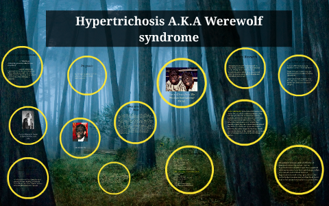 Hypertrichosis A.K.A Werewolf syndrome by Patricia Guzman on Prezi
