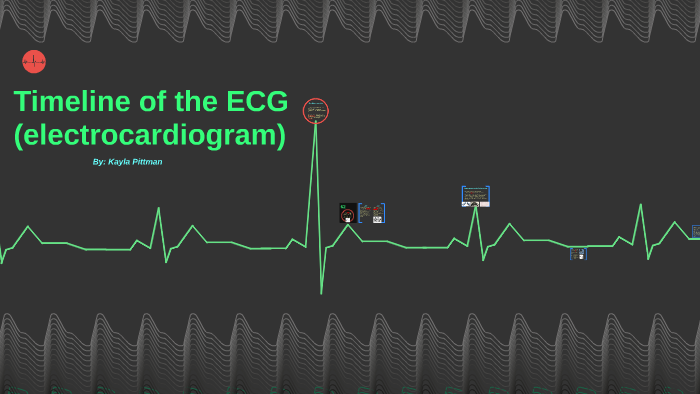 Timeline of the EKG (electrocardiogram) by Kayla Pittman