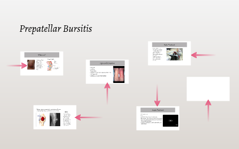 Bursitis by Courtney Roark on Prezi