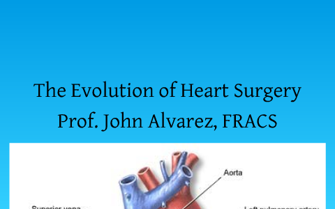 The Evolution of Heart surgery. by shahid jamil on Prezi