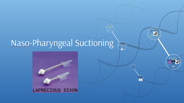 Nasal-Pharyngeal Suctioning by La Smith on Prezi