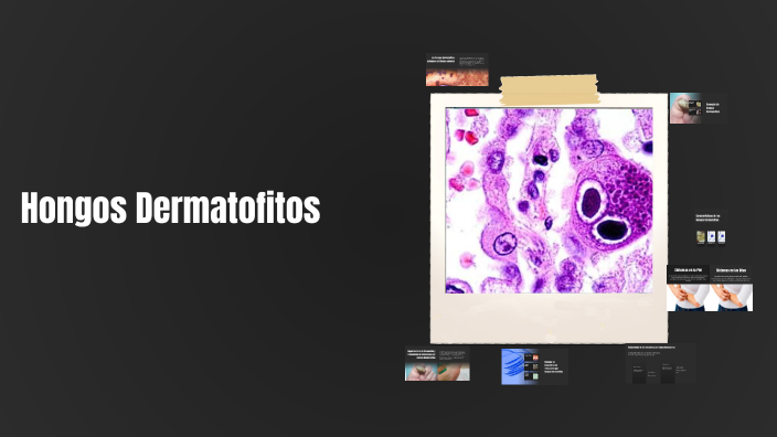 Hongos Dermatofitos by Roosevelt on Prezi