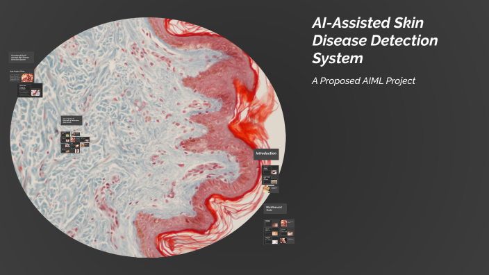 AI-Assisted Skin Disease Detection System by Anonymous Anonymous on Prezi