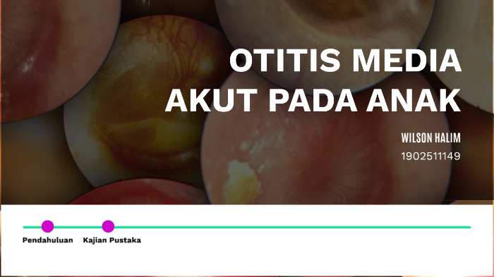 Otitis Media Akut by Wilson Halim on Prezi