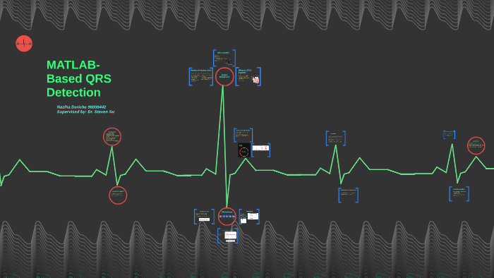 MATLAB-Based QRS Detection by Naziha Mohamed on Prezi
