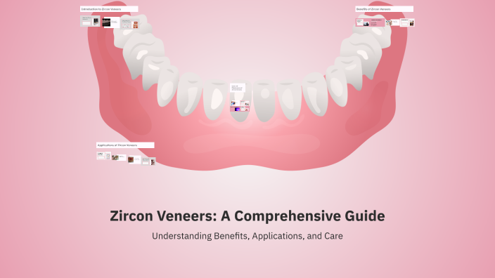 Zircon Veneers: A Comprehensive Guide by Ali Cheaib on Prezi