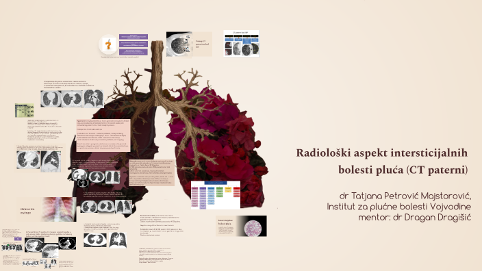 Chest CT Patterns of Interstitial Lung Disease by Tanja Petrovic on Prezi