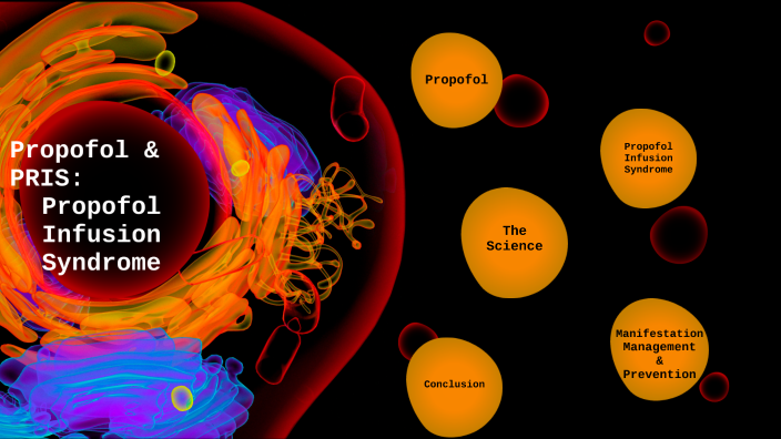 PRIS: Propofol Infusion Syndrome by Alysha M on Prezi